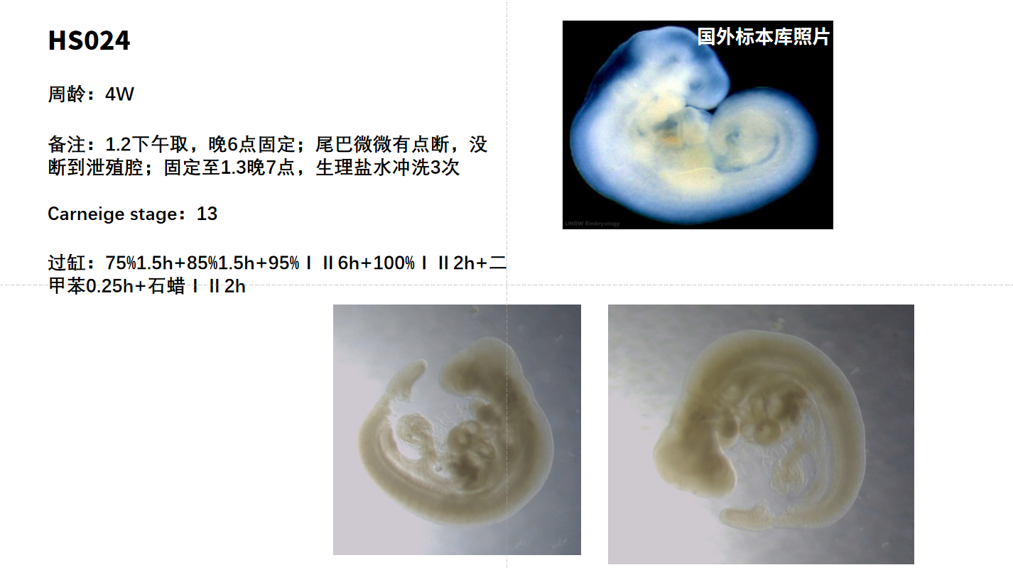 tmp95B6 — Postimages