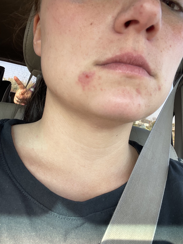 C1222266 9403 4 ED9 828 F C142 F3500 C17 — Postimages