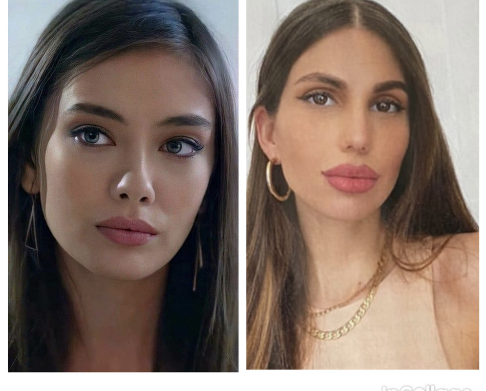 EA4 C0353 448 A 496 D B192 9 C37 C514 AF0 F — Postimages