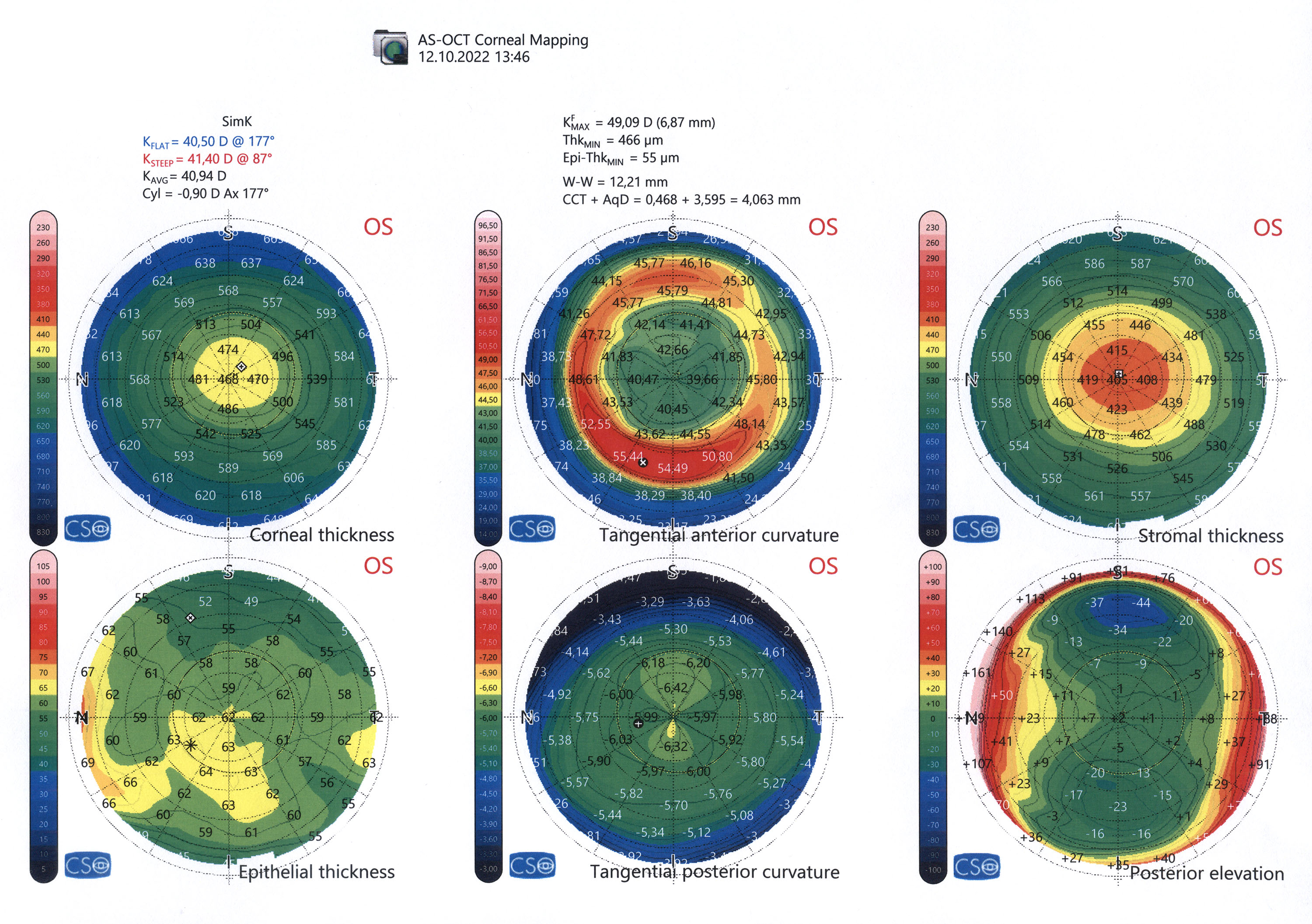 2022 10 12 05 AS OCT Corneal Mapping, Corneal thickness etc ( OS ...