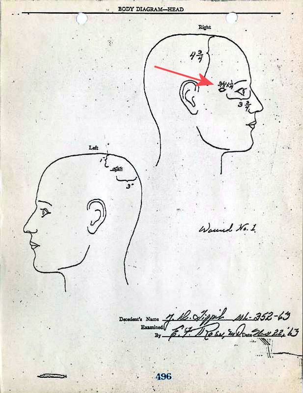 The Tippit Witnesses --- Part V - JFK Assassination Debate - The ...