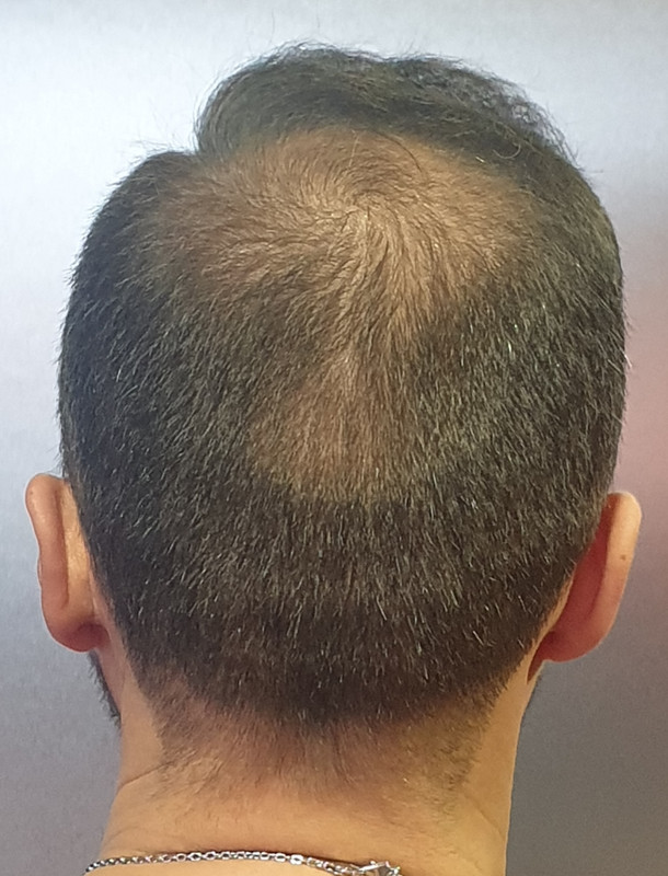 Point Blur Dec082019 163704 — Postimages