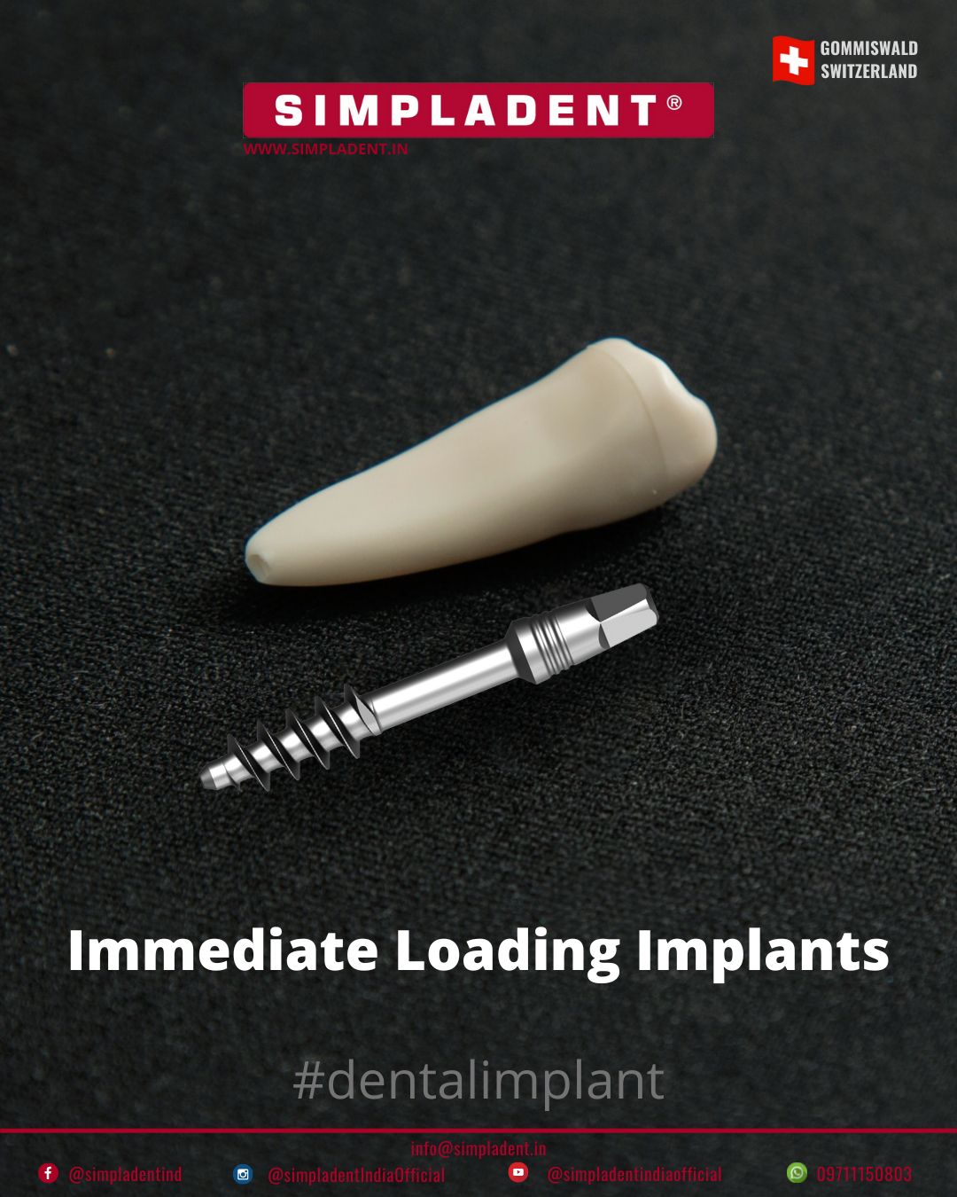 Immediate Loading Implants — Postimages