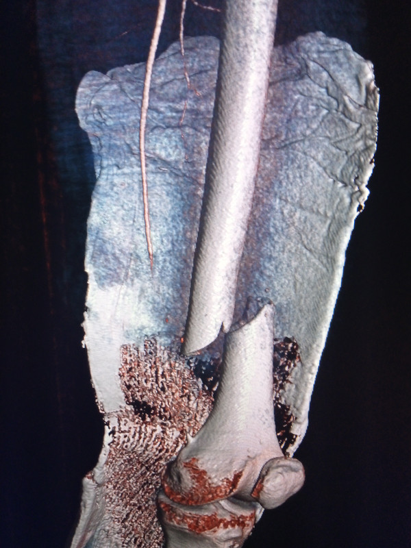 Clinical correlation: leg becoming blue : r/Radiology