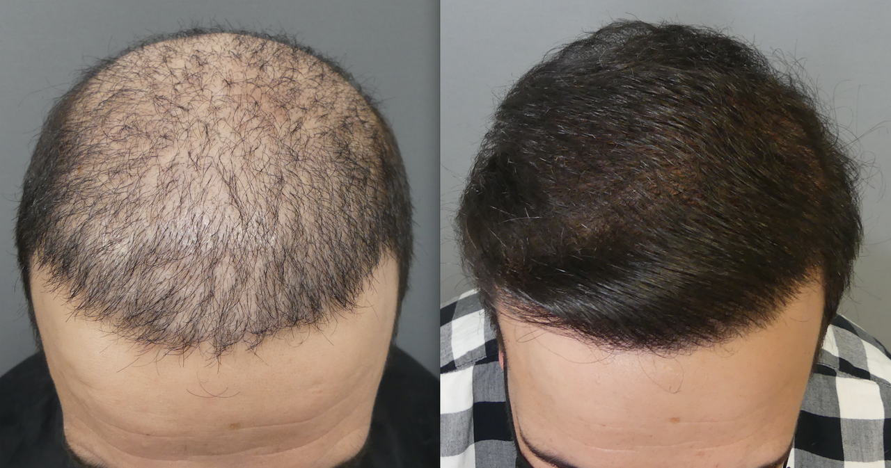 39 MAP16 11 21 COMP2 — Postimages