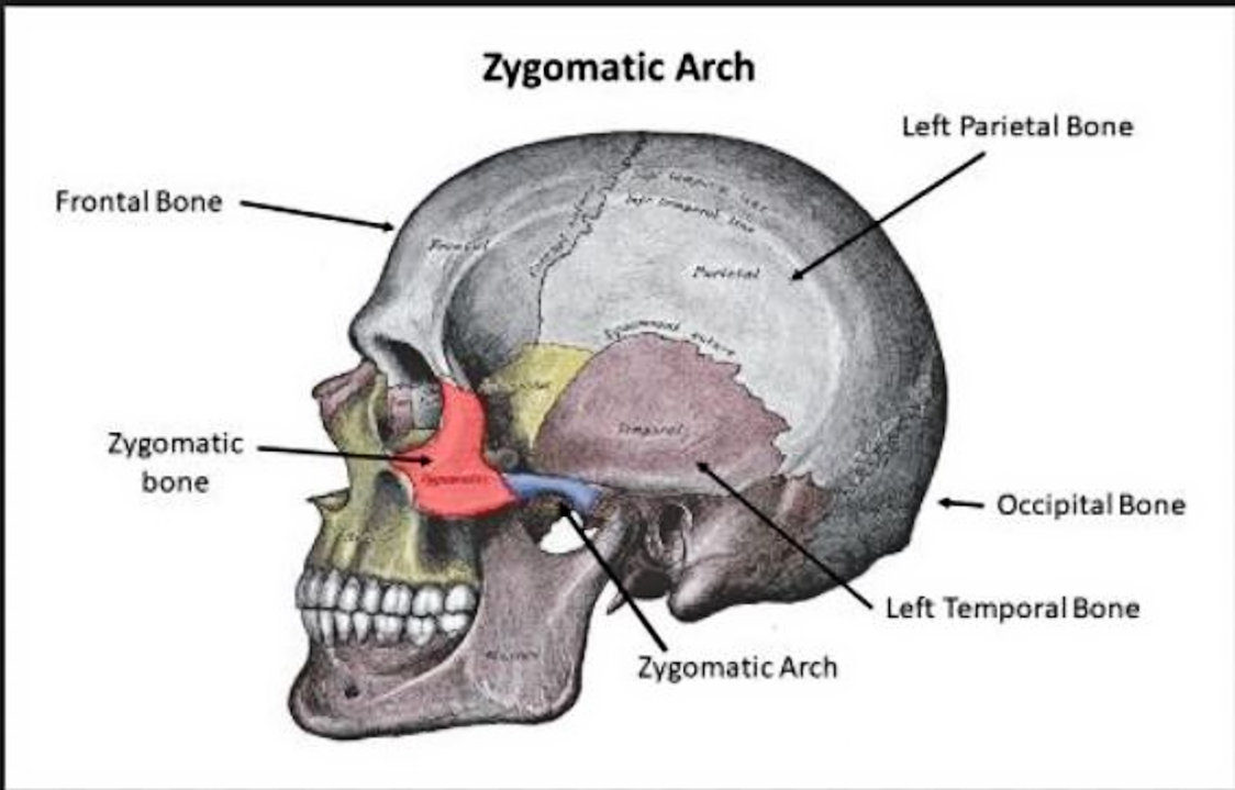 Zygomatic Arch Arcus Zygomaticus Kenhub