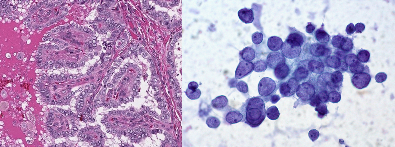 GitHub - isi-mube/Digital-Cytology-ML: Computer Vision application to ...