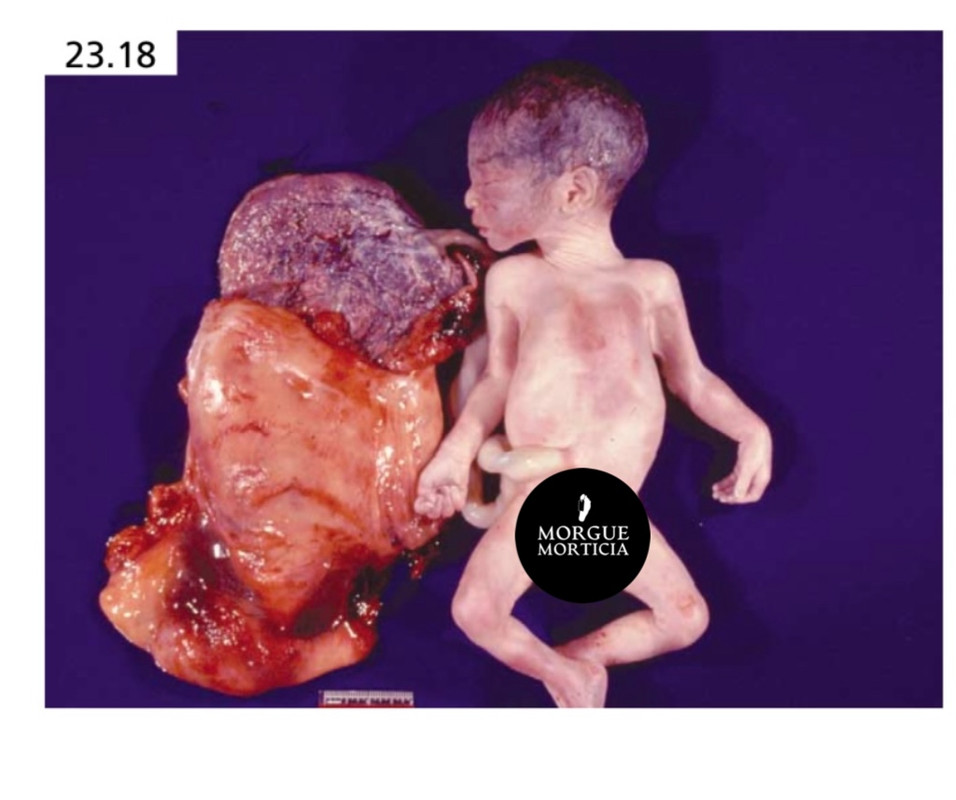 IMG 0834 — Postimages