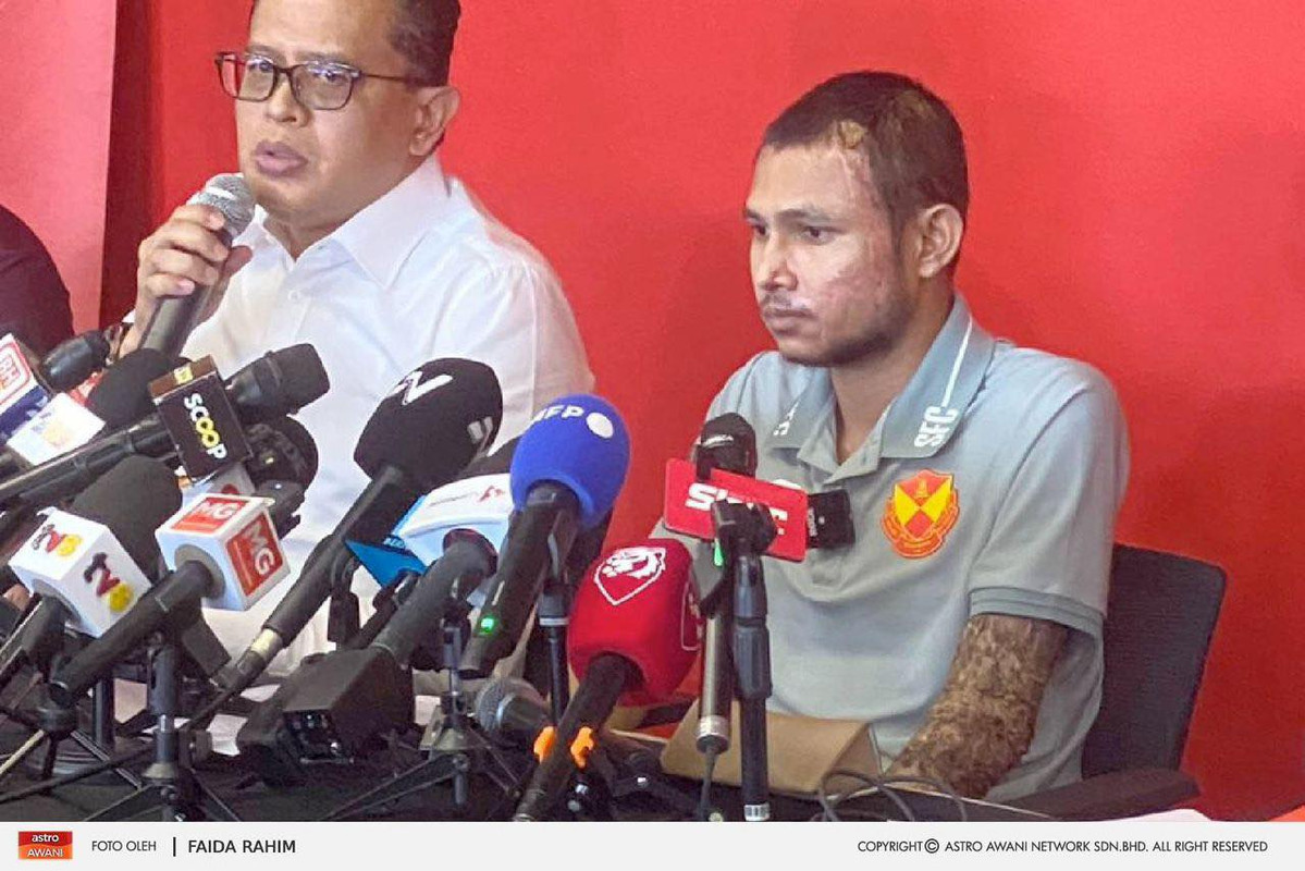 Faisal Halim teruk kesan kena simbah asid