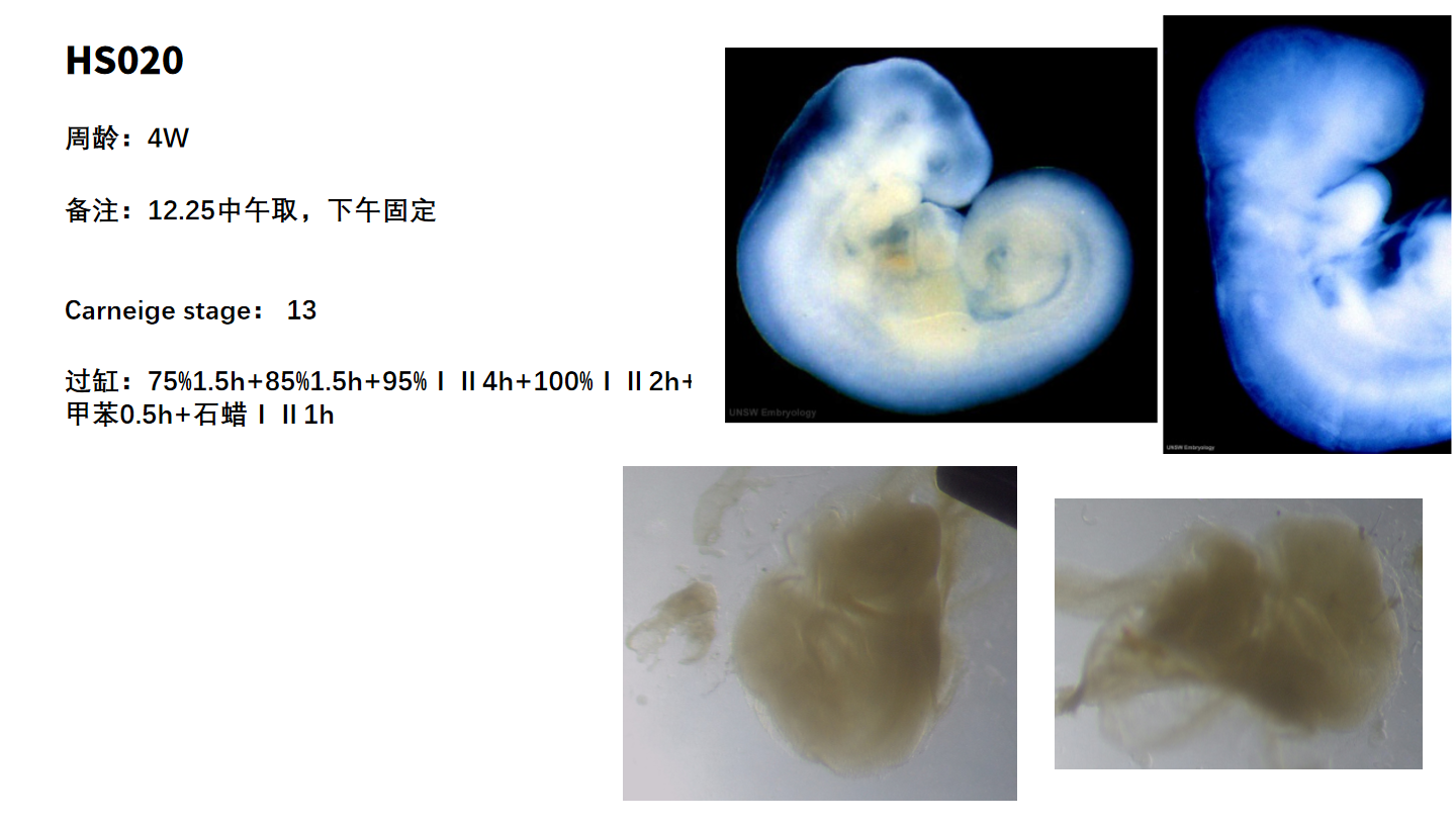 tmp611F — Postimages