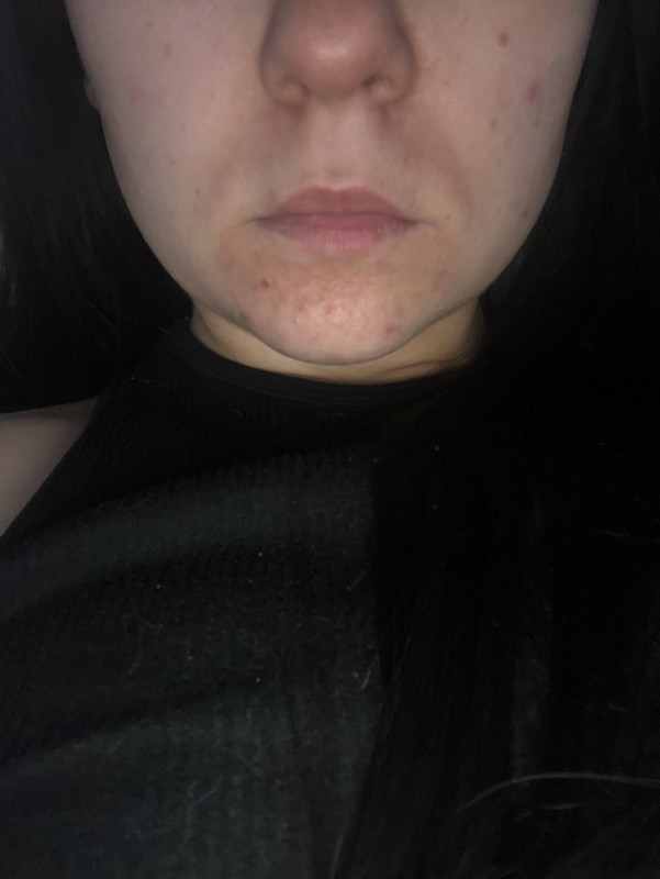 DA57149 B 5410 434 C 81 E1 2638 CB339 CB6 — Postimages