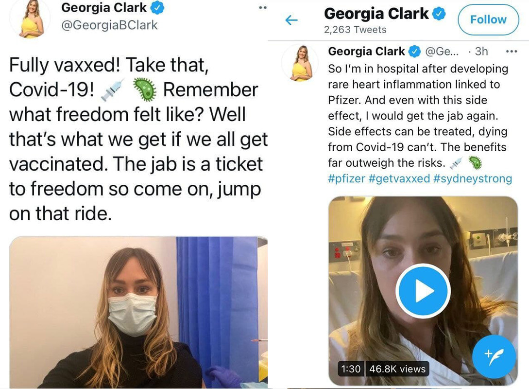 before after jab — Postimages