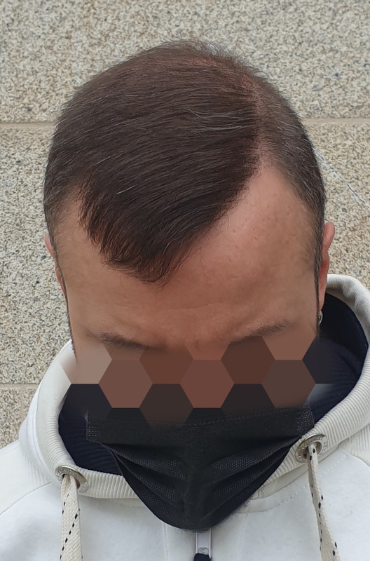 Point Blur Mar012022 111454 — Postimages