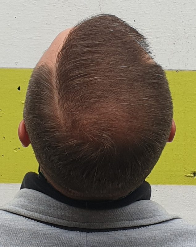 Point Blur Oct032021 101118 — Postimages