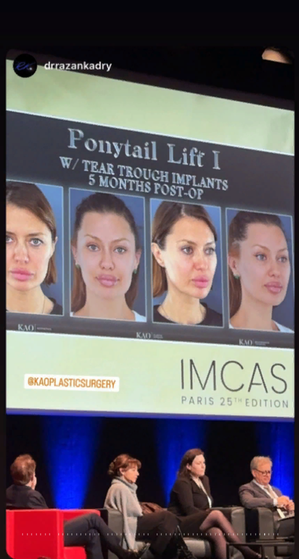 август а май август боня янв како конгресс 1 — Postimages