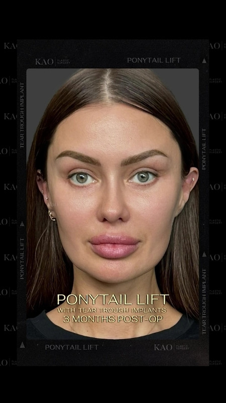 бо (2) — Postimages