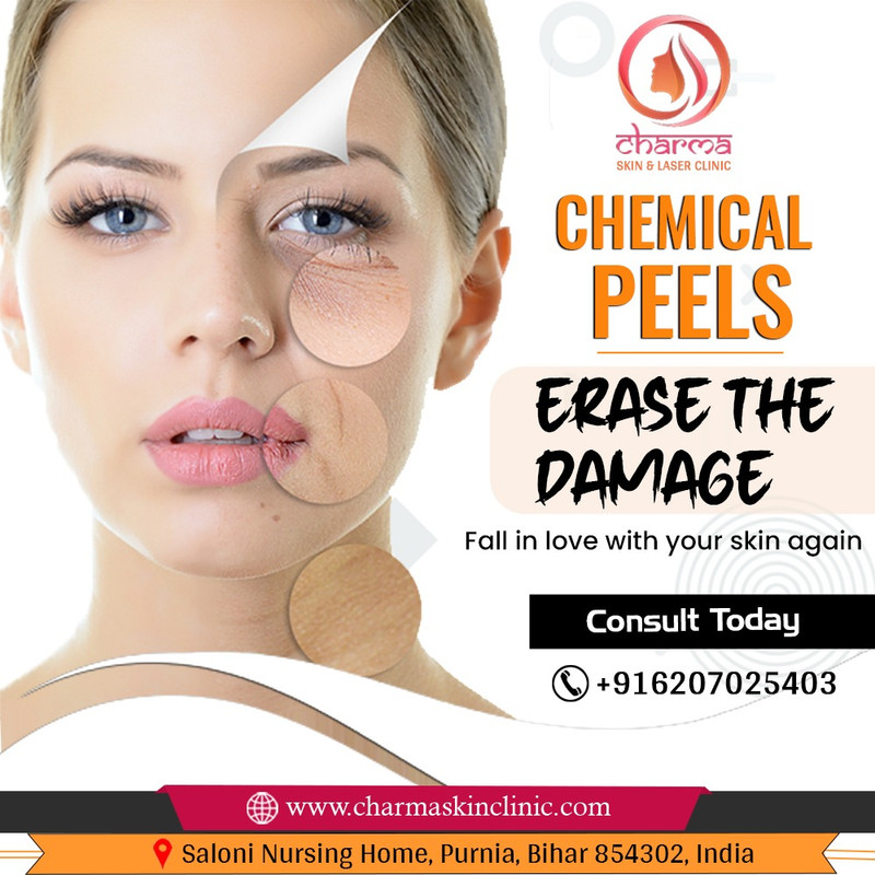 Best Chemical Peels Treatment Clinic Saloni Nursing Home — Postimages