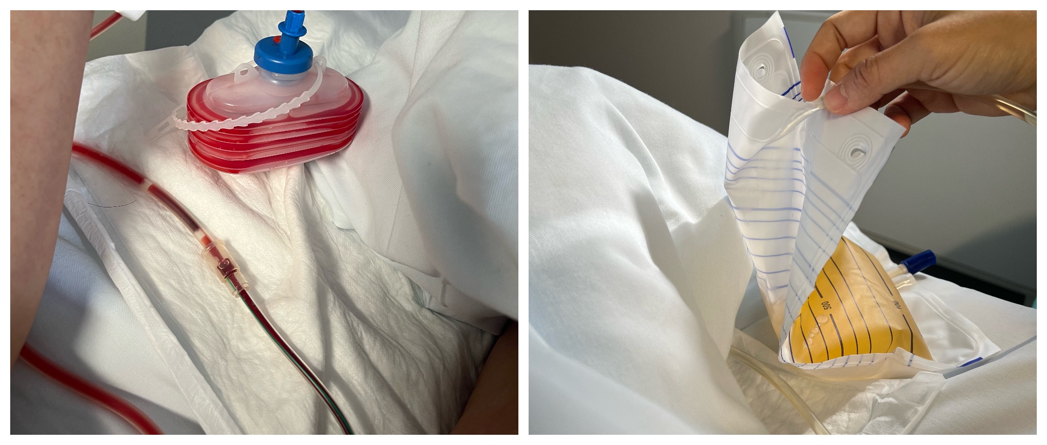 Drainage tubes — Postimages