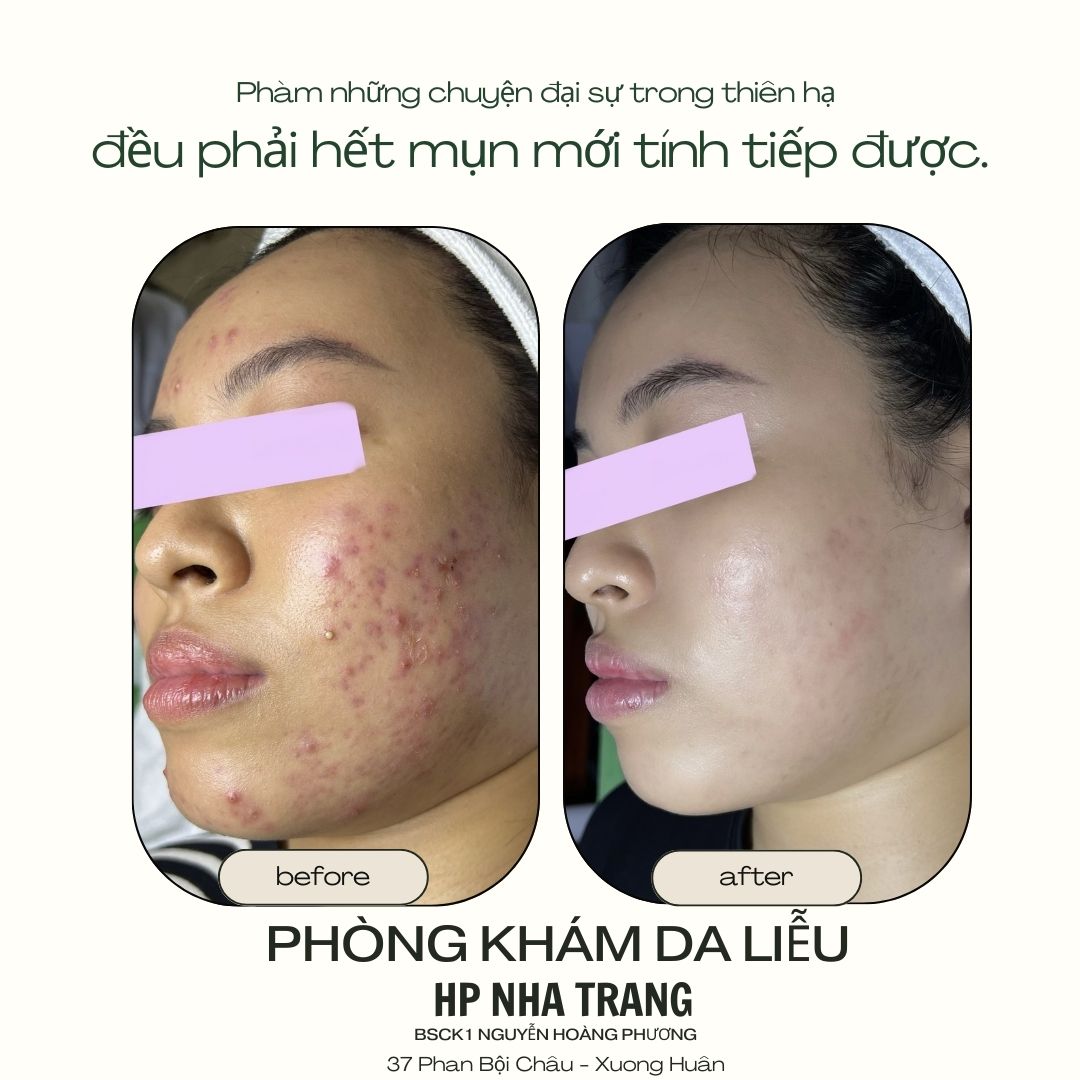 Neutral Minimalist Modern Hair Beauty Salon Before After Instagram Post (2) — Postimages