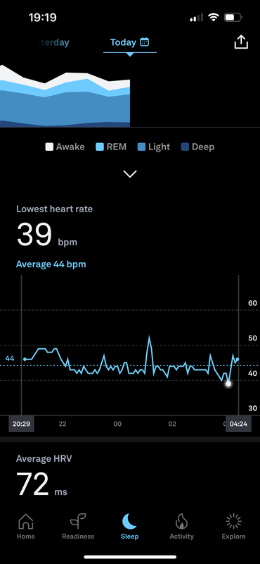 Heart rate of 14 bpm I’m thinking that’s bad? > General Discussion ...