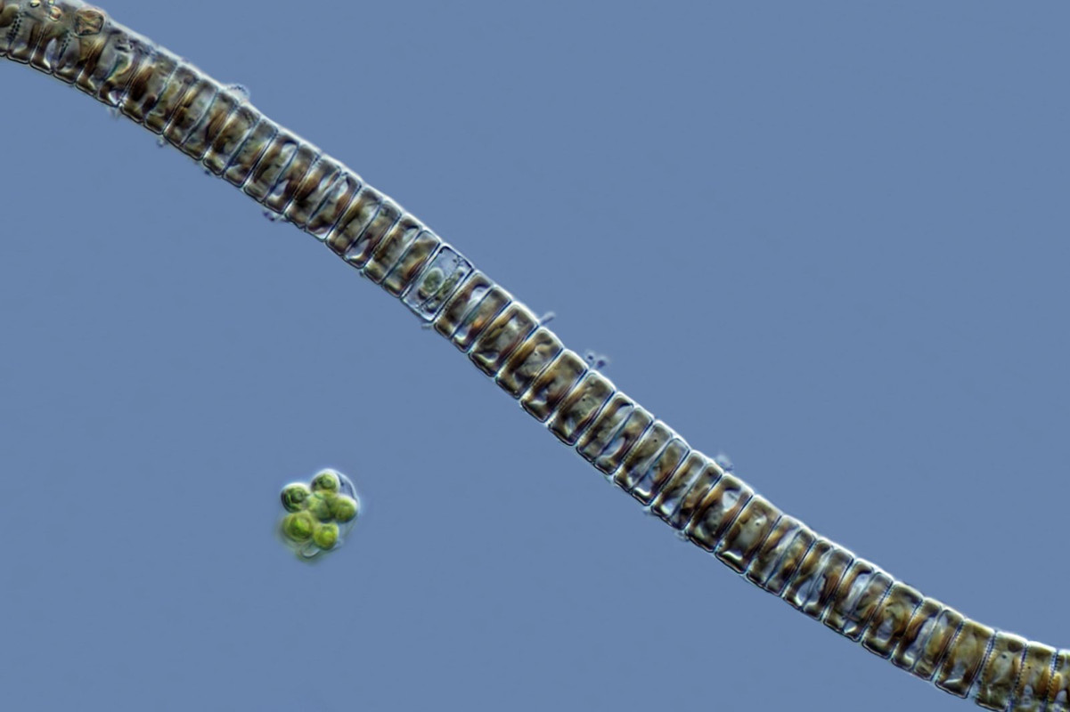 Eunotia 06 sp Bogen Alge VA DIK 100 Stack 3 — Postimages