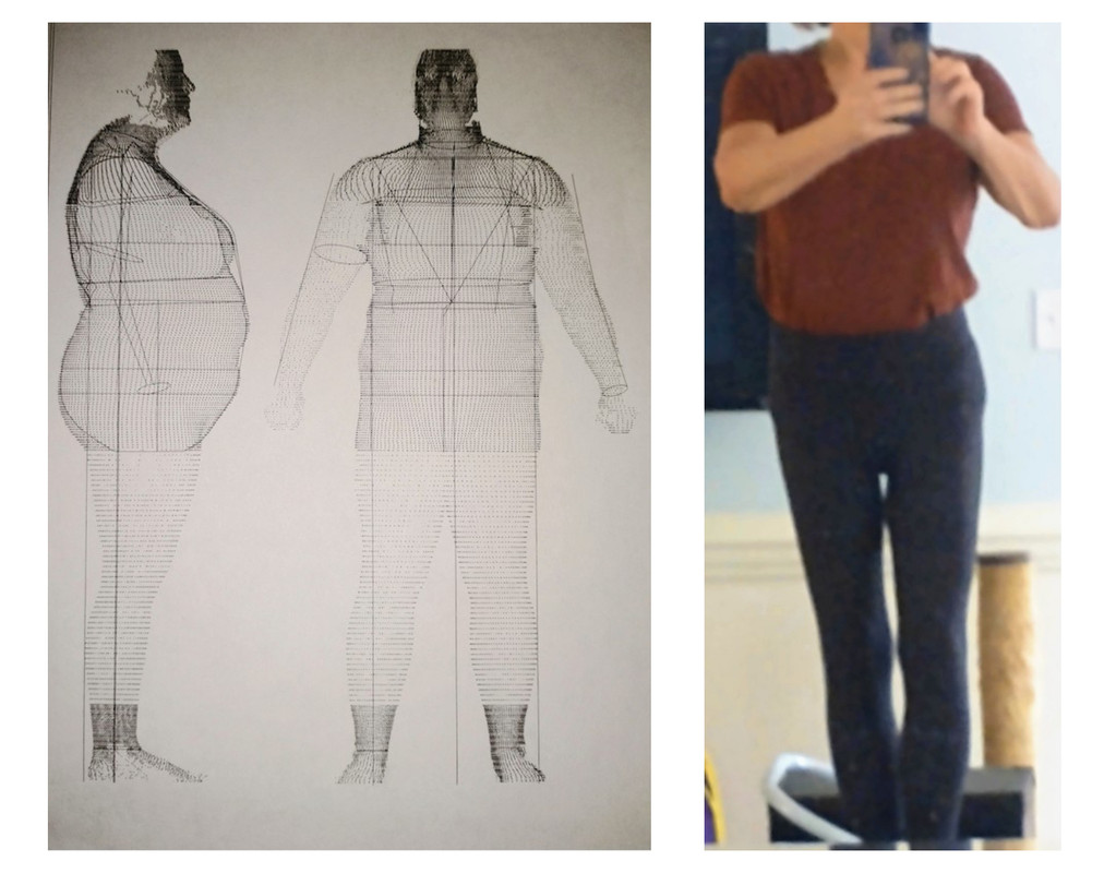 Bodyscan From Highest Weight Compared To Now : r/Mounjaro