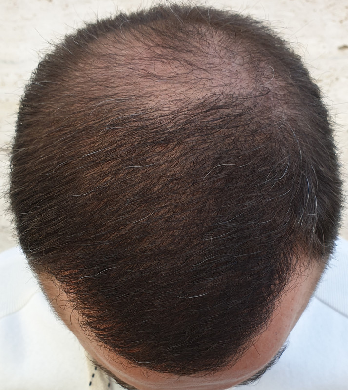 Point Blur Mar212021 234902 — Postimages