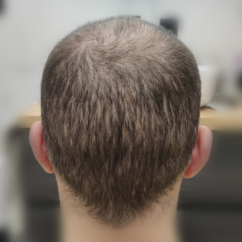 MOD Dietro1 — Postimages