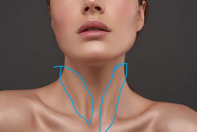 Are there any morphs that adjust the sternocleidomastoid (two vertical ...