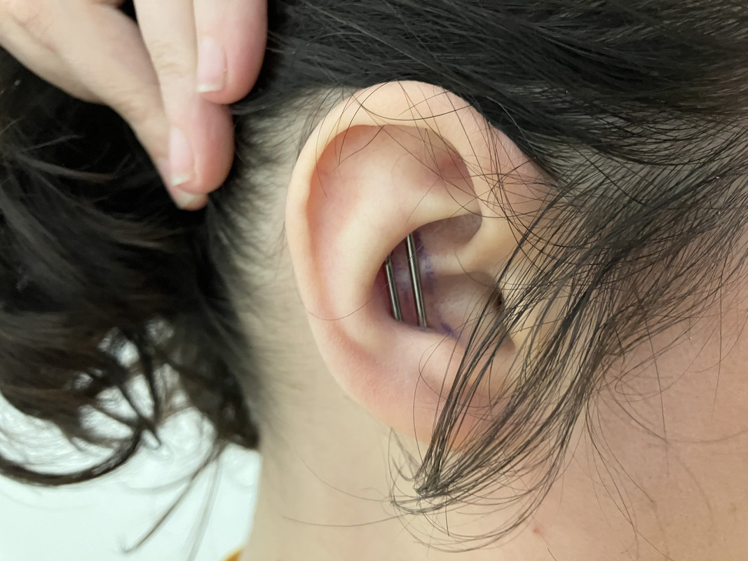 IMG 1973 — Postimages