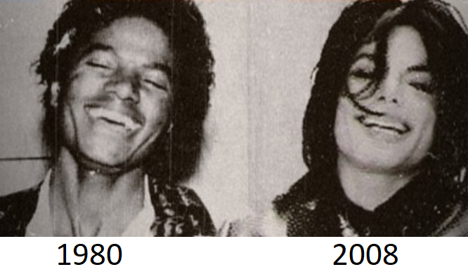 Based on these photos, would you say Michael Jackson had a natural jaw ...