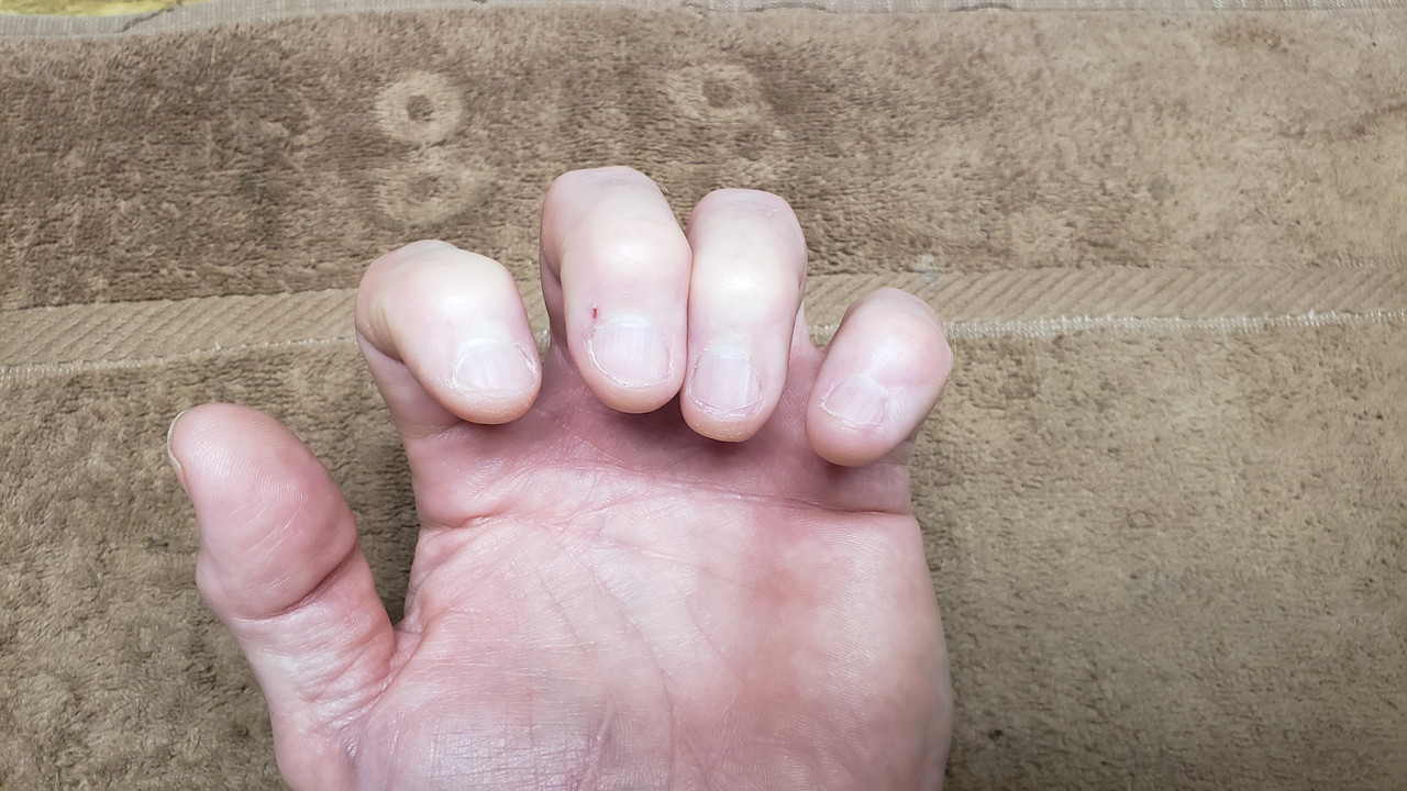 Left hand middle fingers refuse to separate. - The Acoustic Guitar Forum