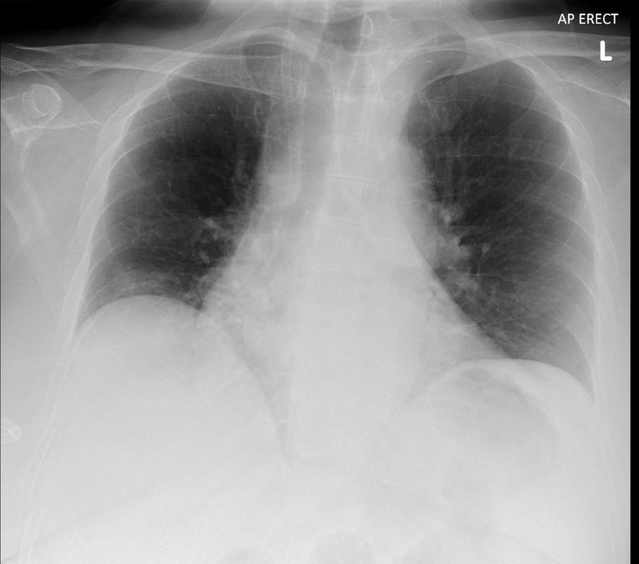 Case 1 Series 4 — Postimages