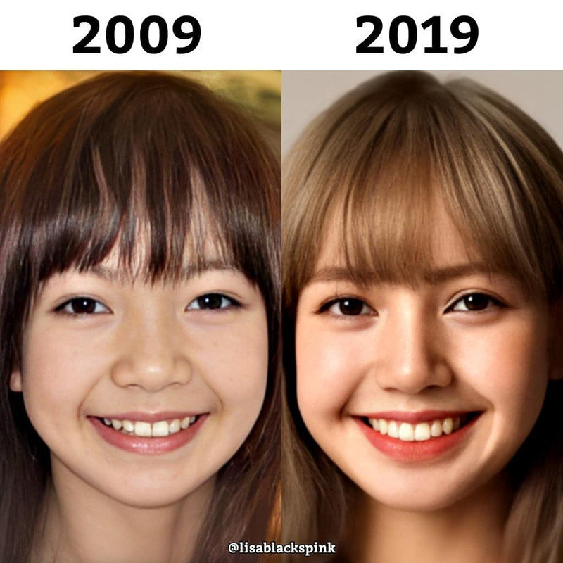 Blackpink Before And After Plastic Surgery Blackpink