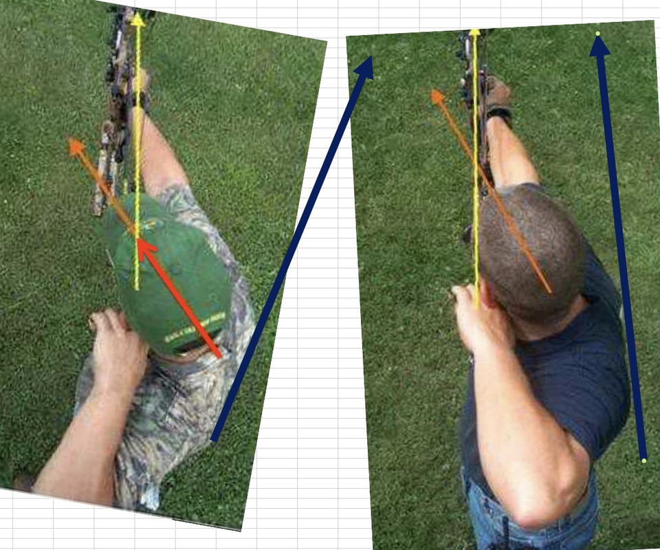Shoulders Alignment LH — Postimages