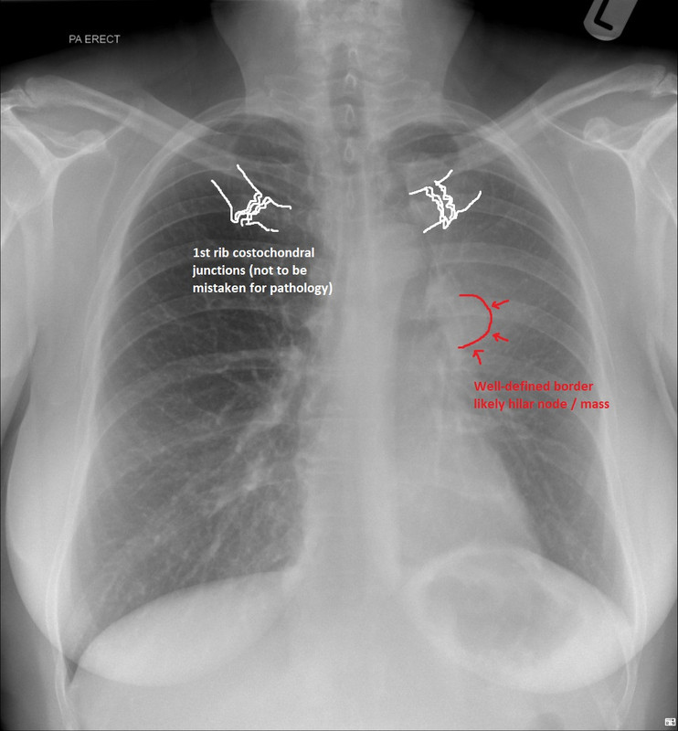 Case 4 annotated2 — Postimages