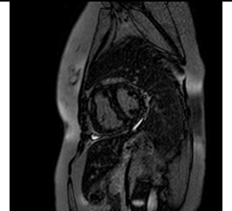 19 D77368 F8 F6 471 E 8 E6 E 2 BAB333 BA9 B1 — Postimages